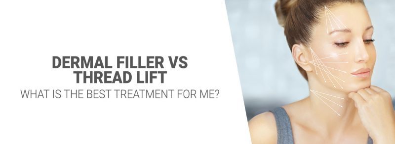 Dermal filler vs thread lift - What is the best treatment for me? – M1 ...